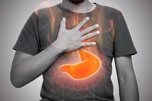 The Connection Between Acid Reflux and Throat Health | Arizona Desert ...
